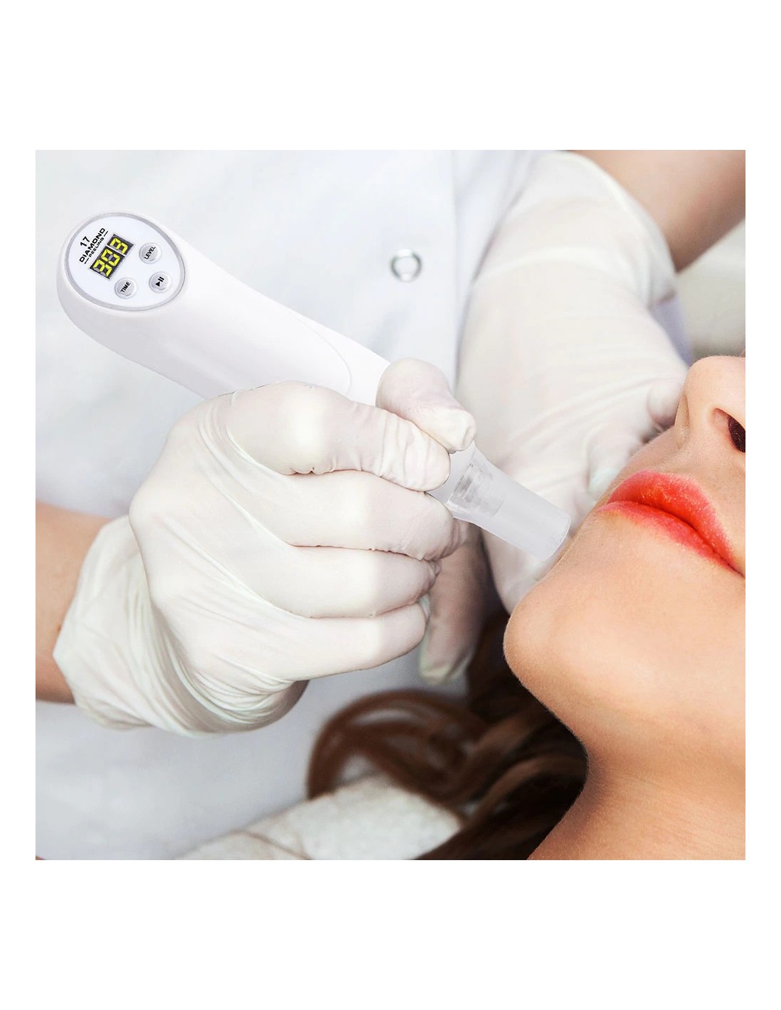 DIAMOND PEELING MICRODERMOABRASÃO VÁCUO | MAQUINAS DE MICRODERMOABRASÃO